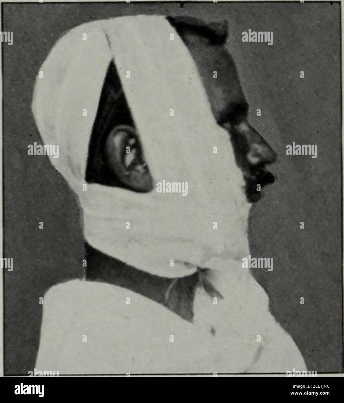 Vented dressing hi-res stock photography and images - Alamy