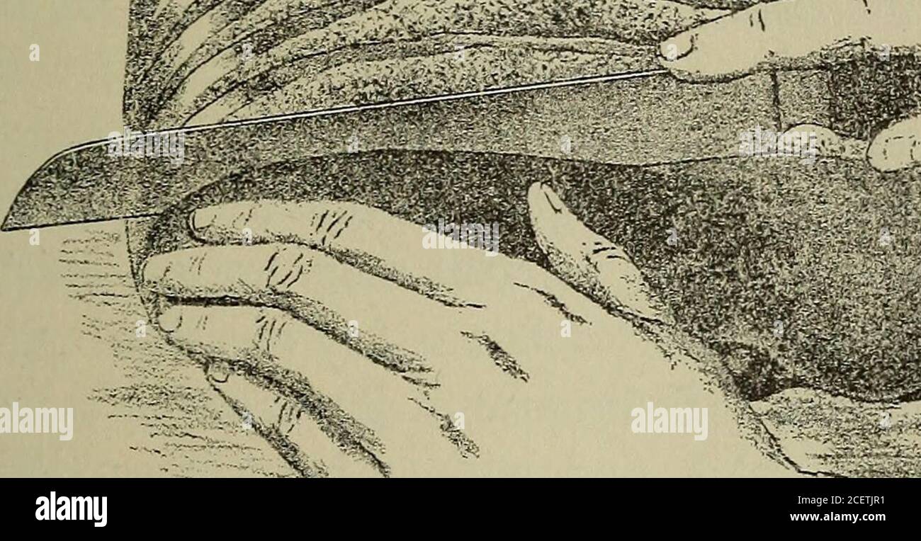 . Postmortem pathology; a manual of the technic of post-mortem ...