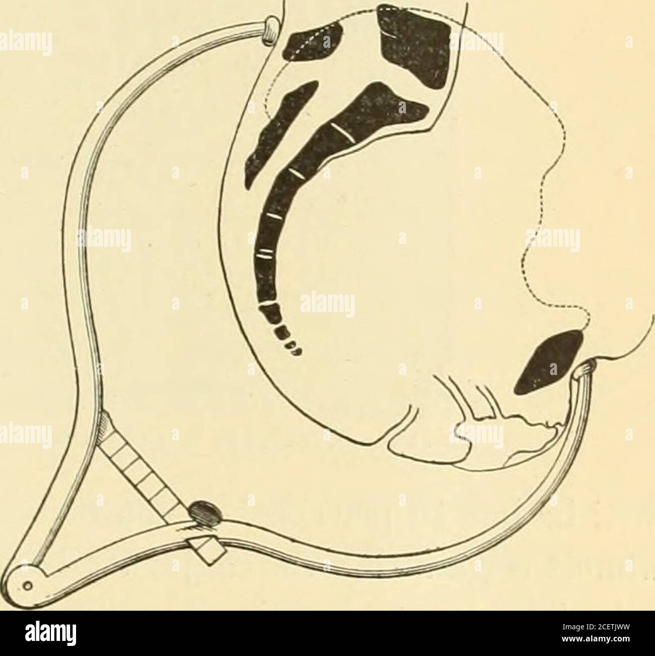 Pelvimeter hi-res stock photography and images - Alamy