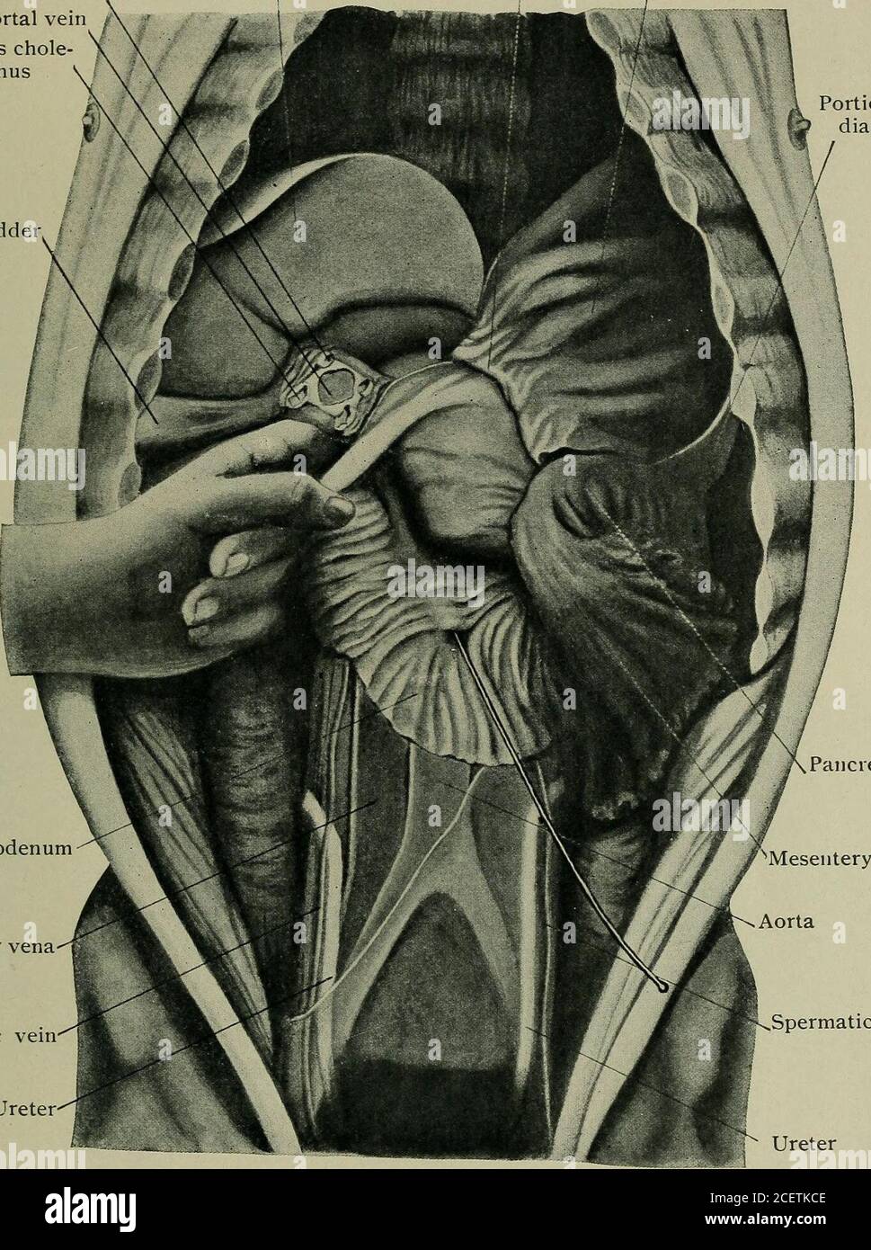 Postmortem Of A Female