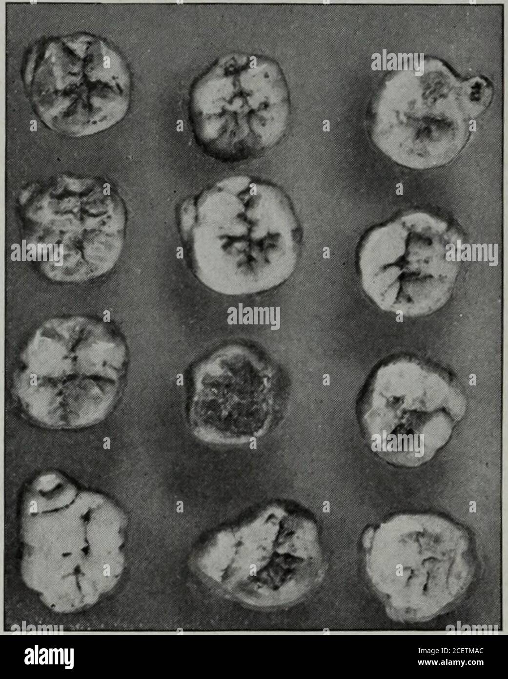 . The Dental cosmos. nt molar in man. Thismuch, however, should be said ...