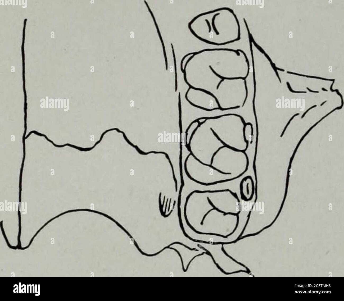. The Dental cosmos. irst and secondmolars, and posterior paramolar ...
