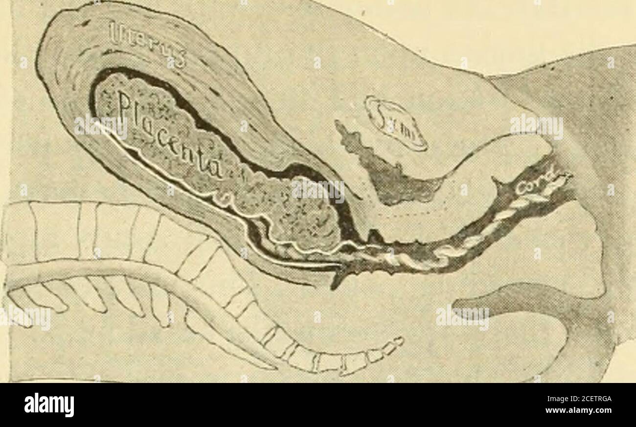 Placenta cake hi-res stock photography and images - Alamy