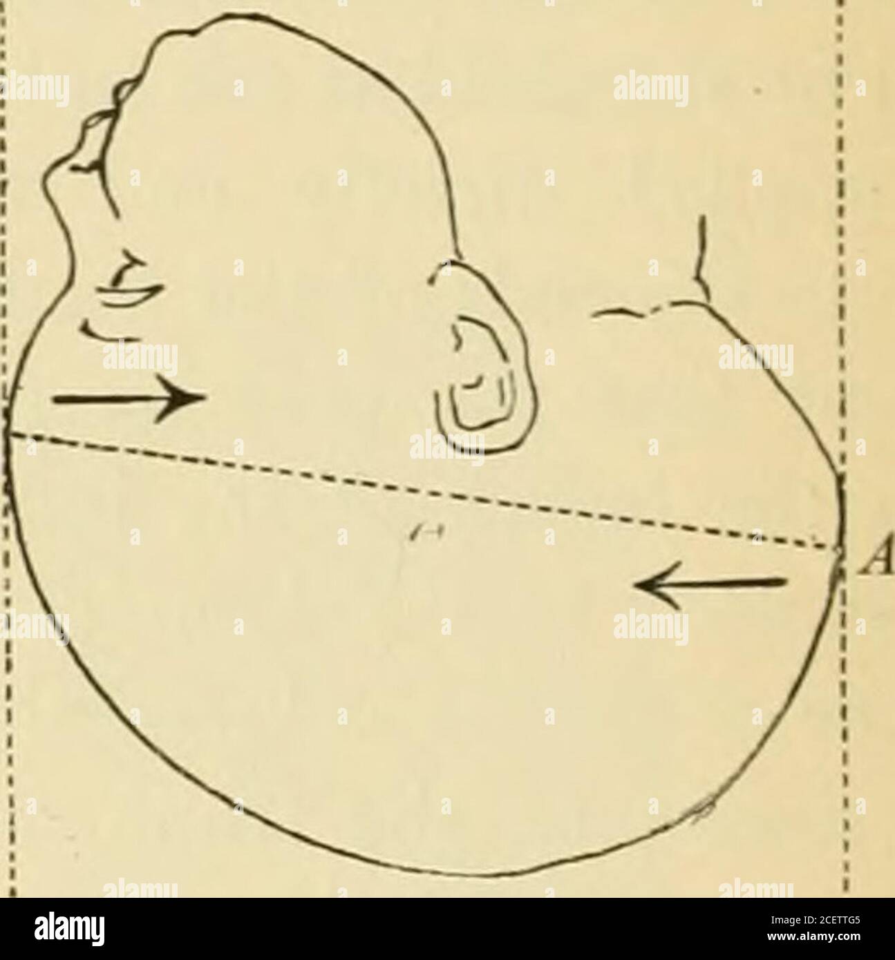 . An American text-book of obstetrics. For practitioners and students ...
