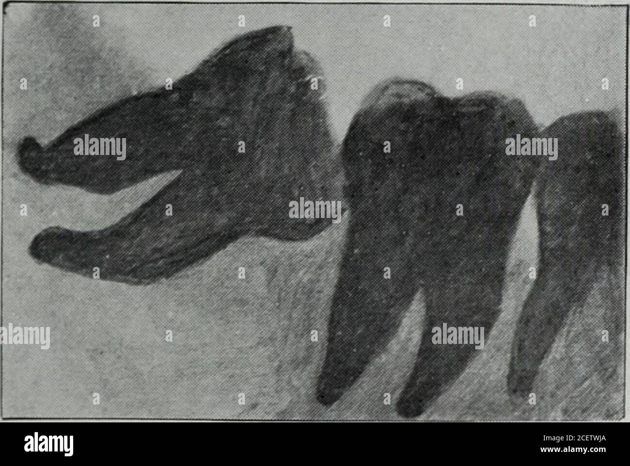 . The Dental cosmos. continued at intervals, and, the painfrom this ...