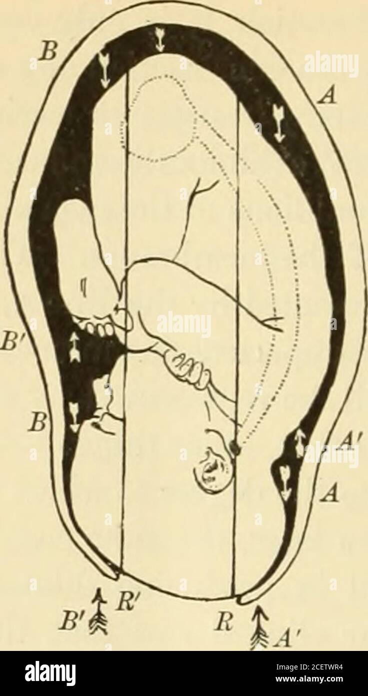. An American text-book of obstetrics. For practitioners and students ...