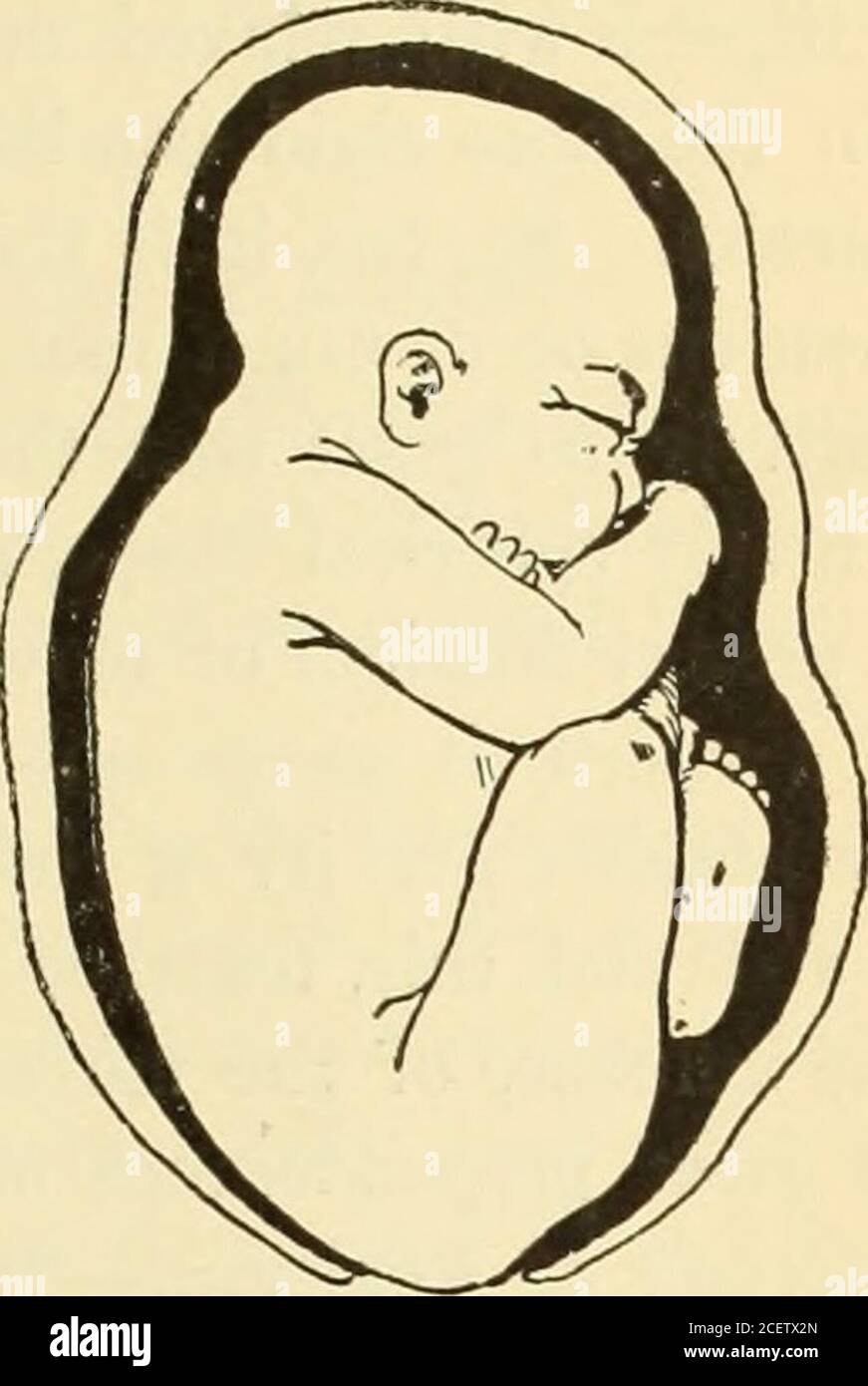 Cephalic presentation hi-res stock photography and images - Alamy