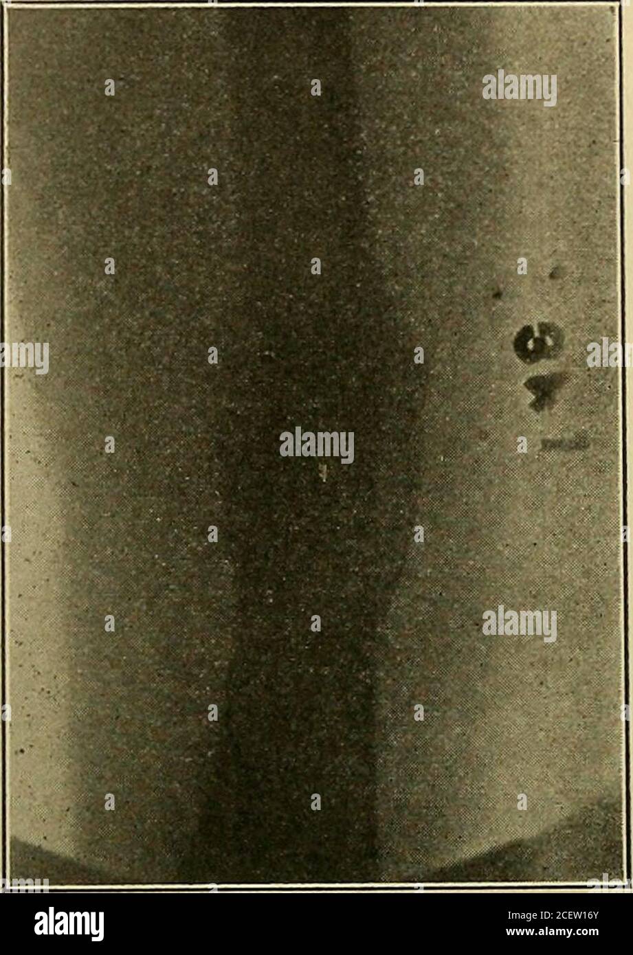 . Medical and surgical report. while Bucks extension was ...