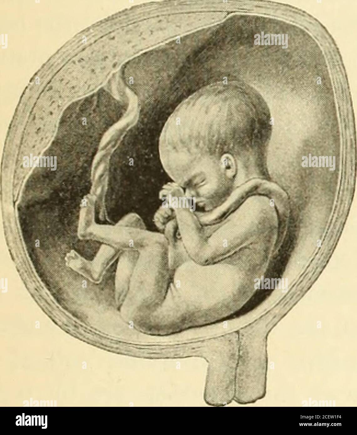 . An American text-book of obstetrics. For practitioners and students ...