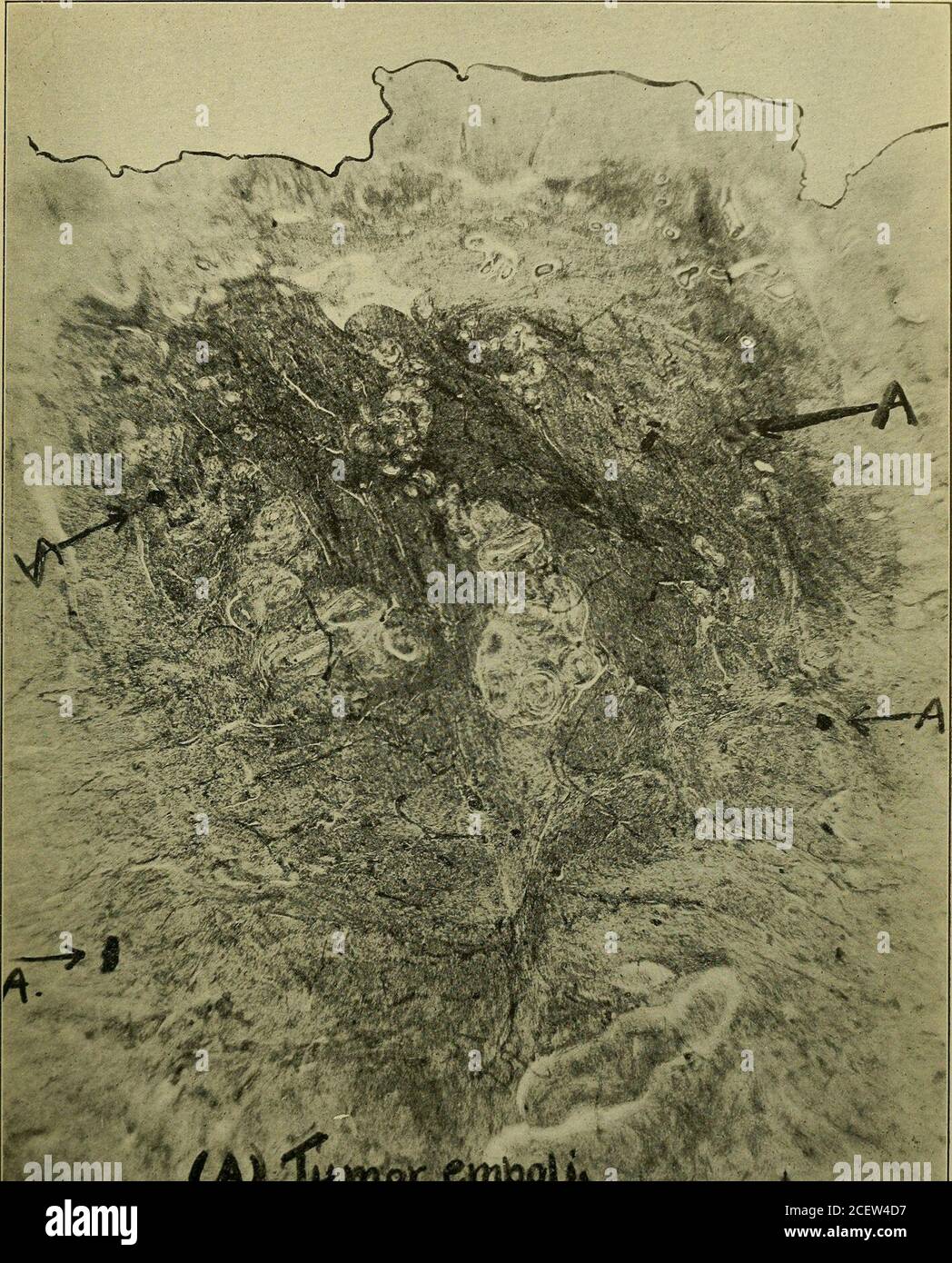 . Medical and surgical report. ther profuse flow of bright red blood ...