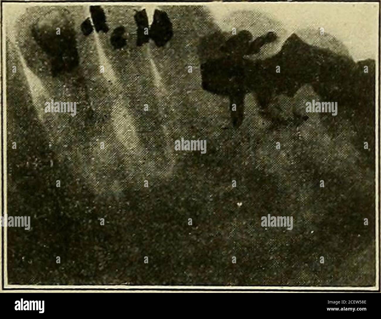 . Medical and surgical report. Fig. 11.—Advanced abscess; no signs or ...