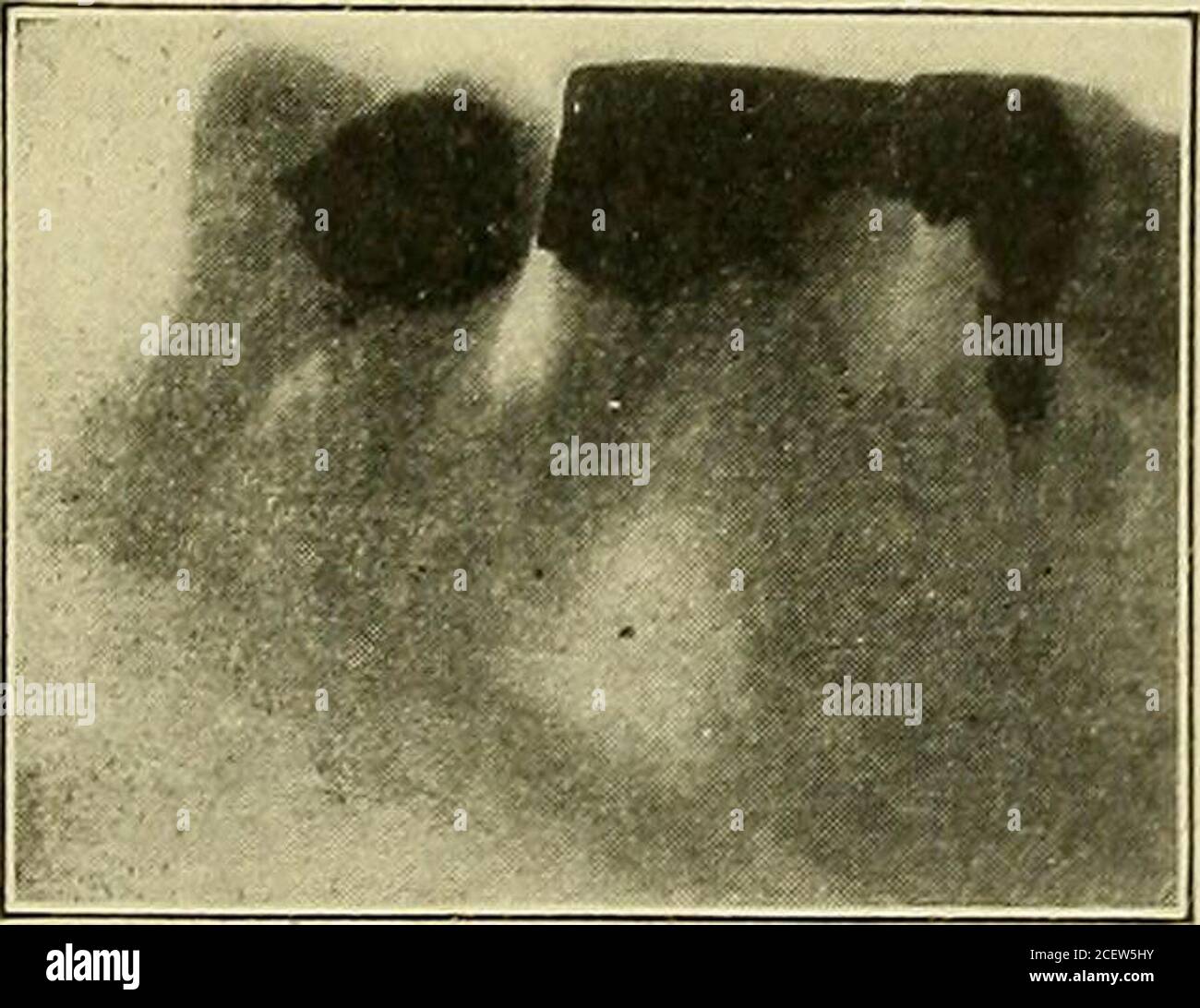 . Medical and surgical report. Fig. 17.—Enlarged skiagram of teeth with ...