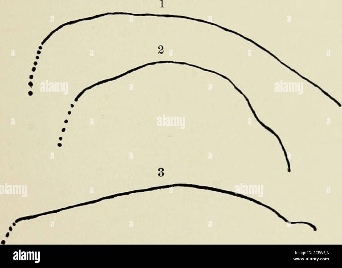 High arched palate hi-res stock photography and images - Alamy