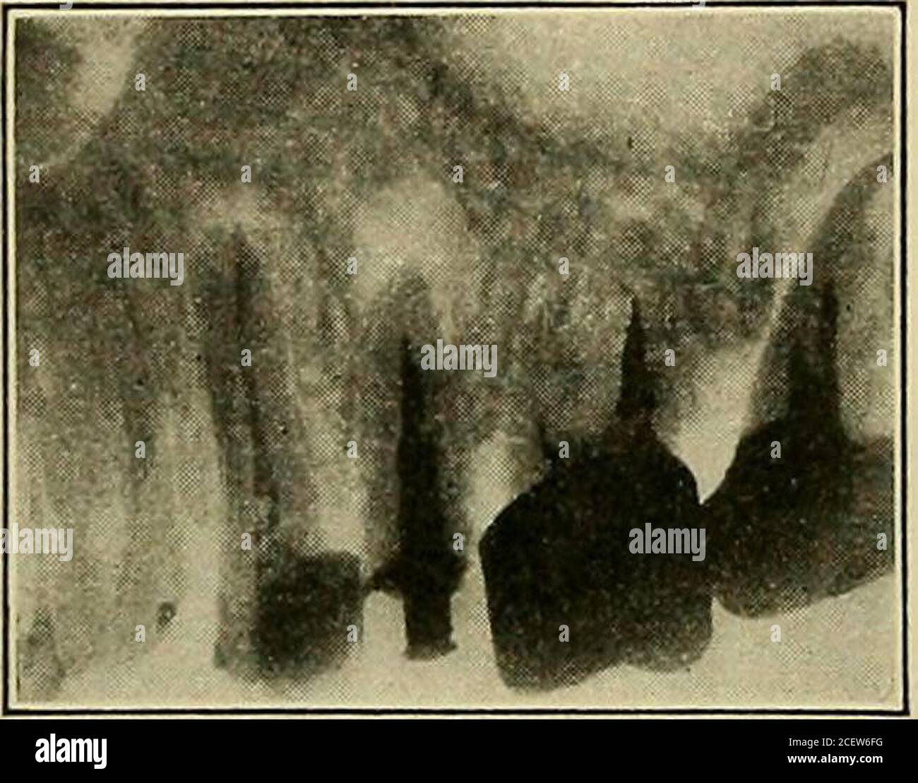 Systemic absorption hi-res stock photography and images - Alamy