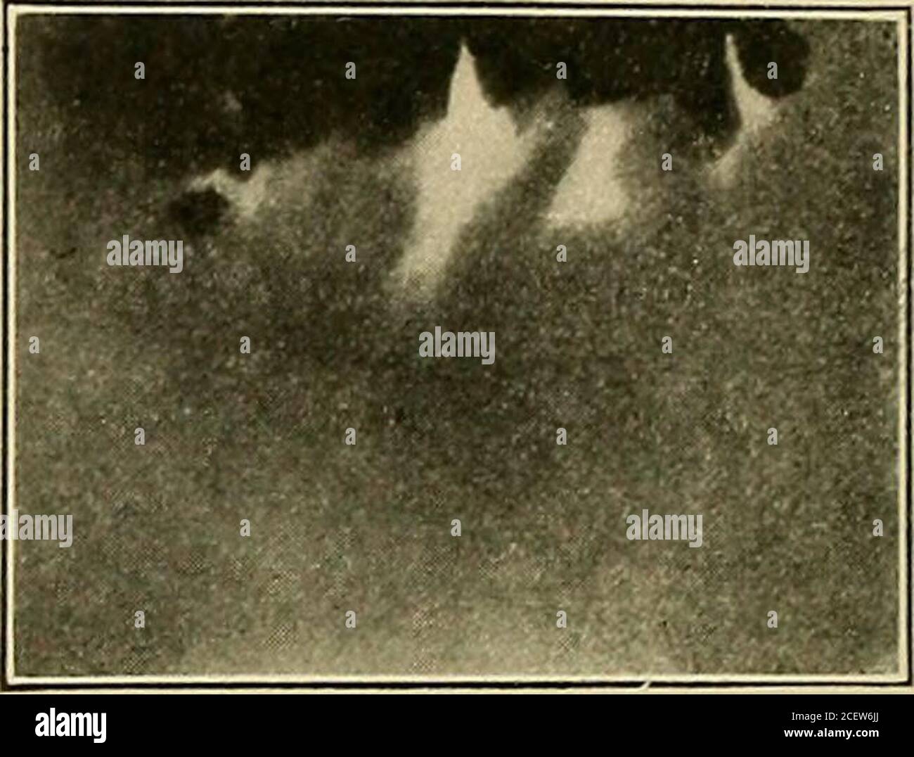 . Medical and surgical report. Fig. 5.—Pus in a bifurcation ...