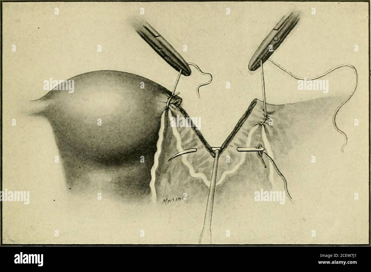 . The Principles and practice of gynecology : for students and ...
