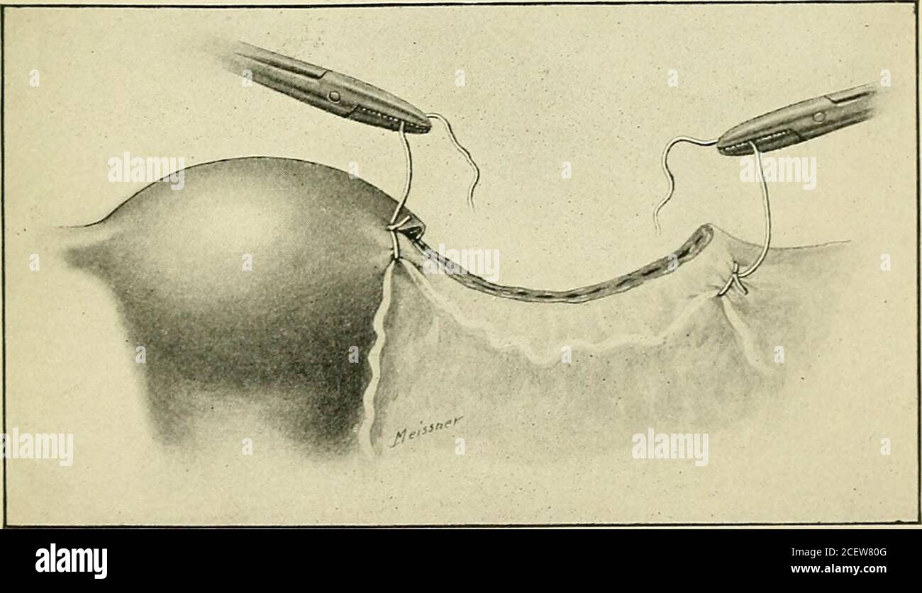 . The Principles and practice of gynecology : for students and ...