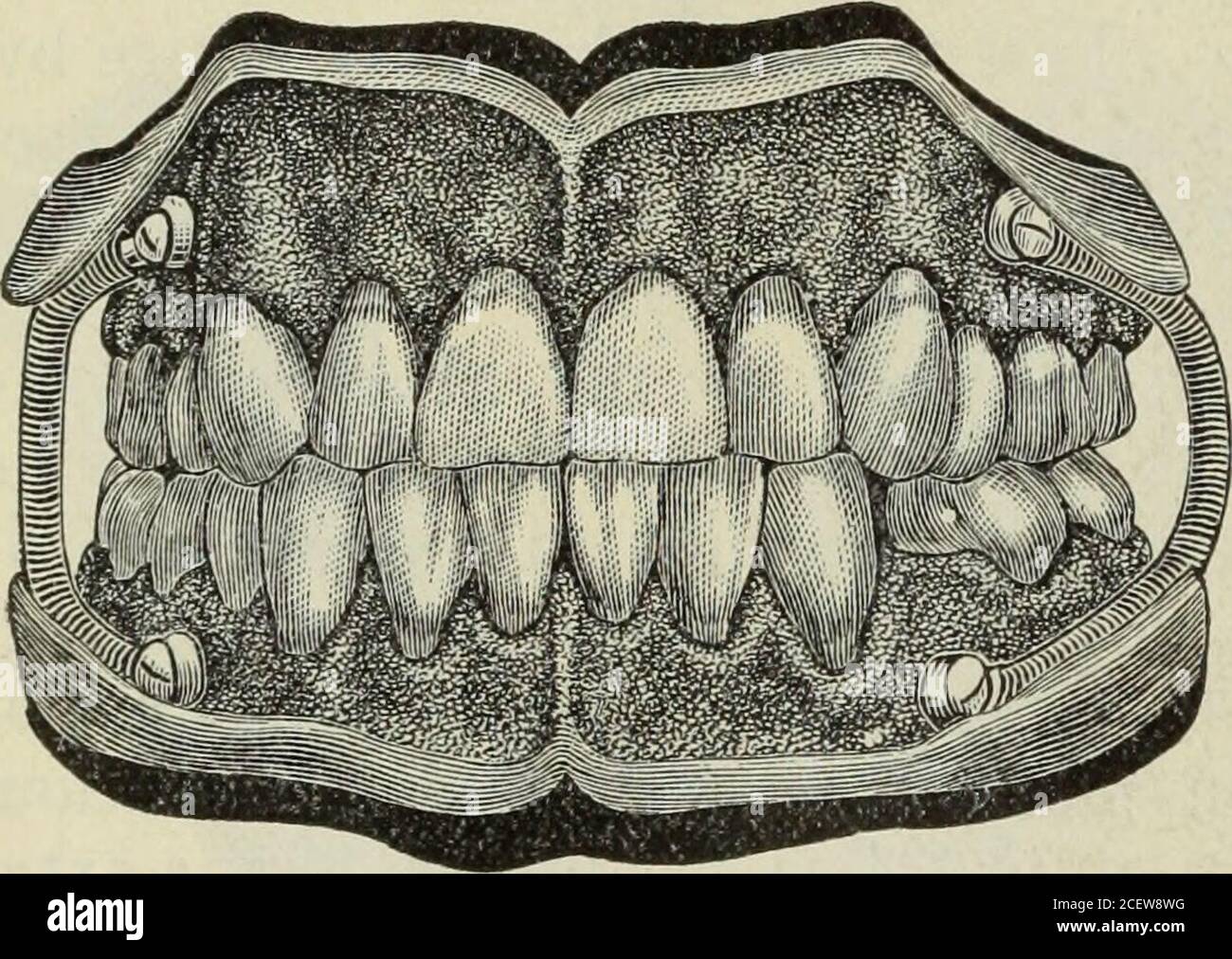. The Dental cosmos. the buccinator horizontally crossthe edge of the ...