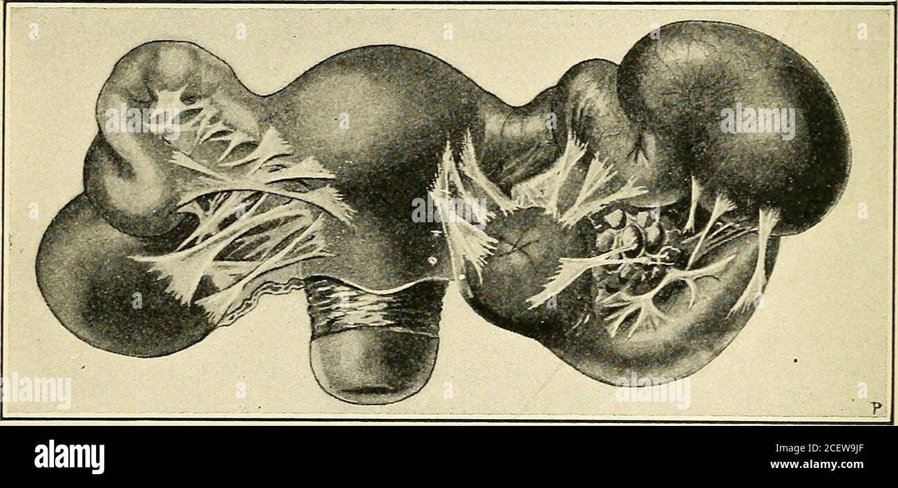 . The Principles and practice of gynecology : for students and ...