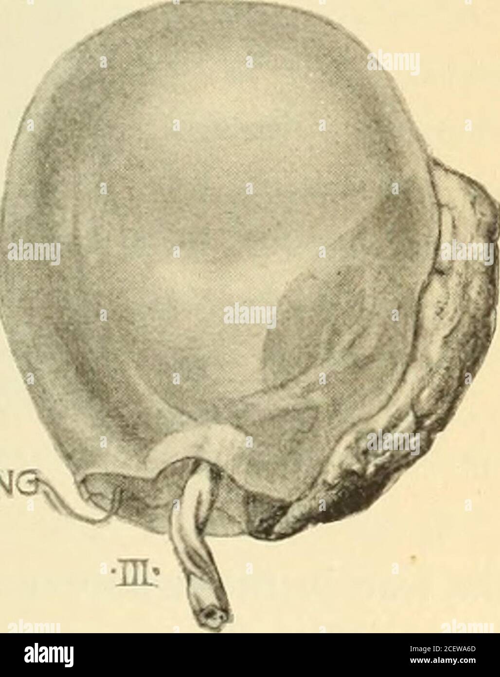 . An American text-book of obstetrics. For practitioners and students ...