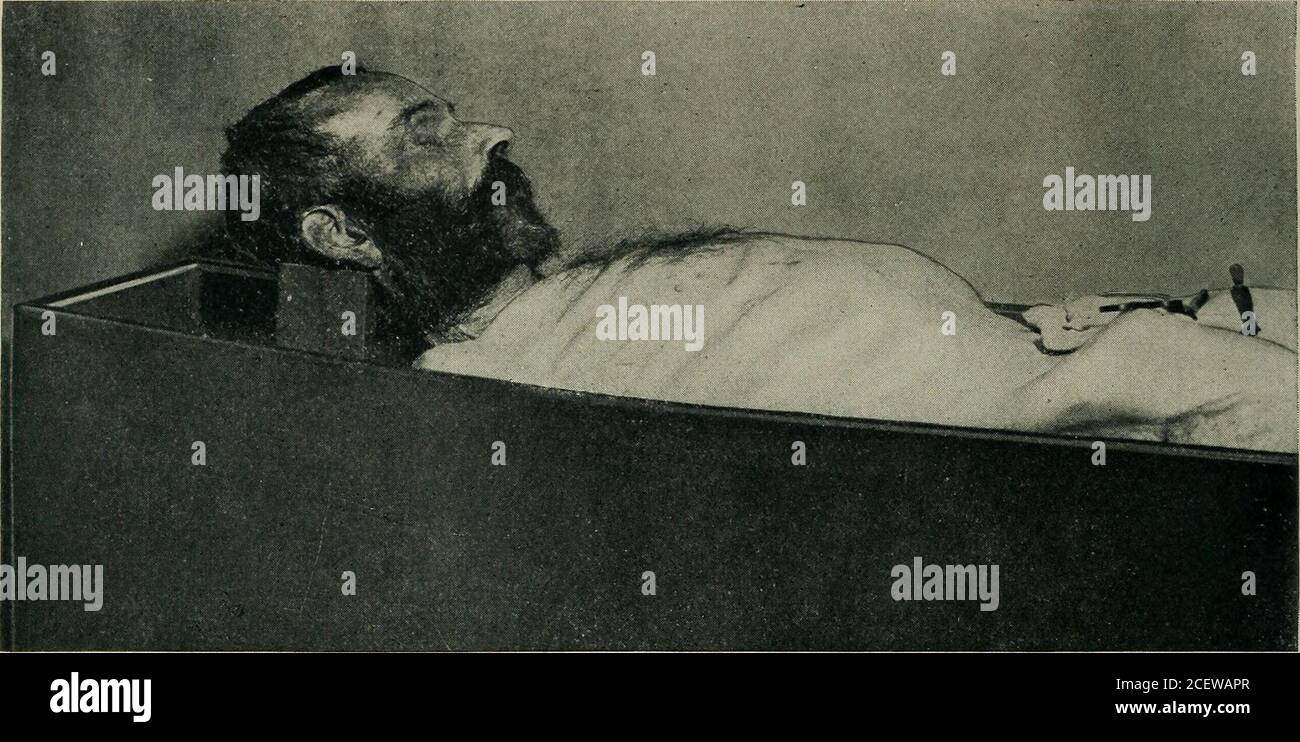 Postmortem examination hi-res stock photography and images - Alamy