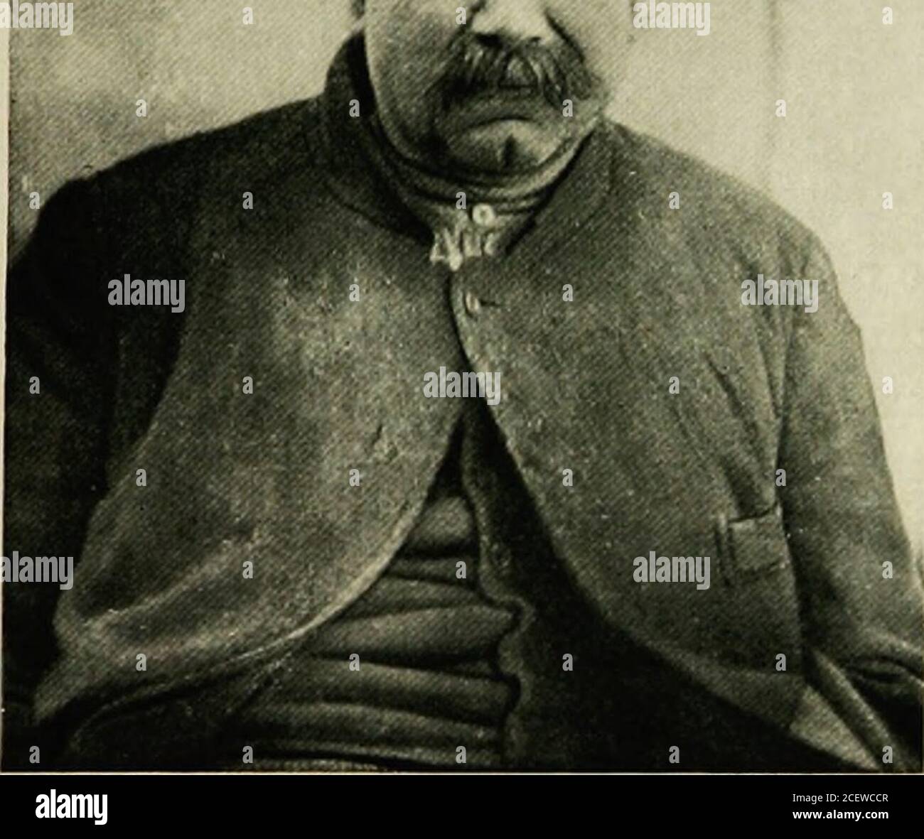 Auditory visual cortex hi-res stock photography and images - Alamy