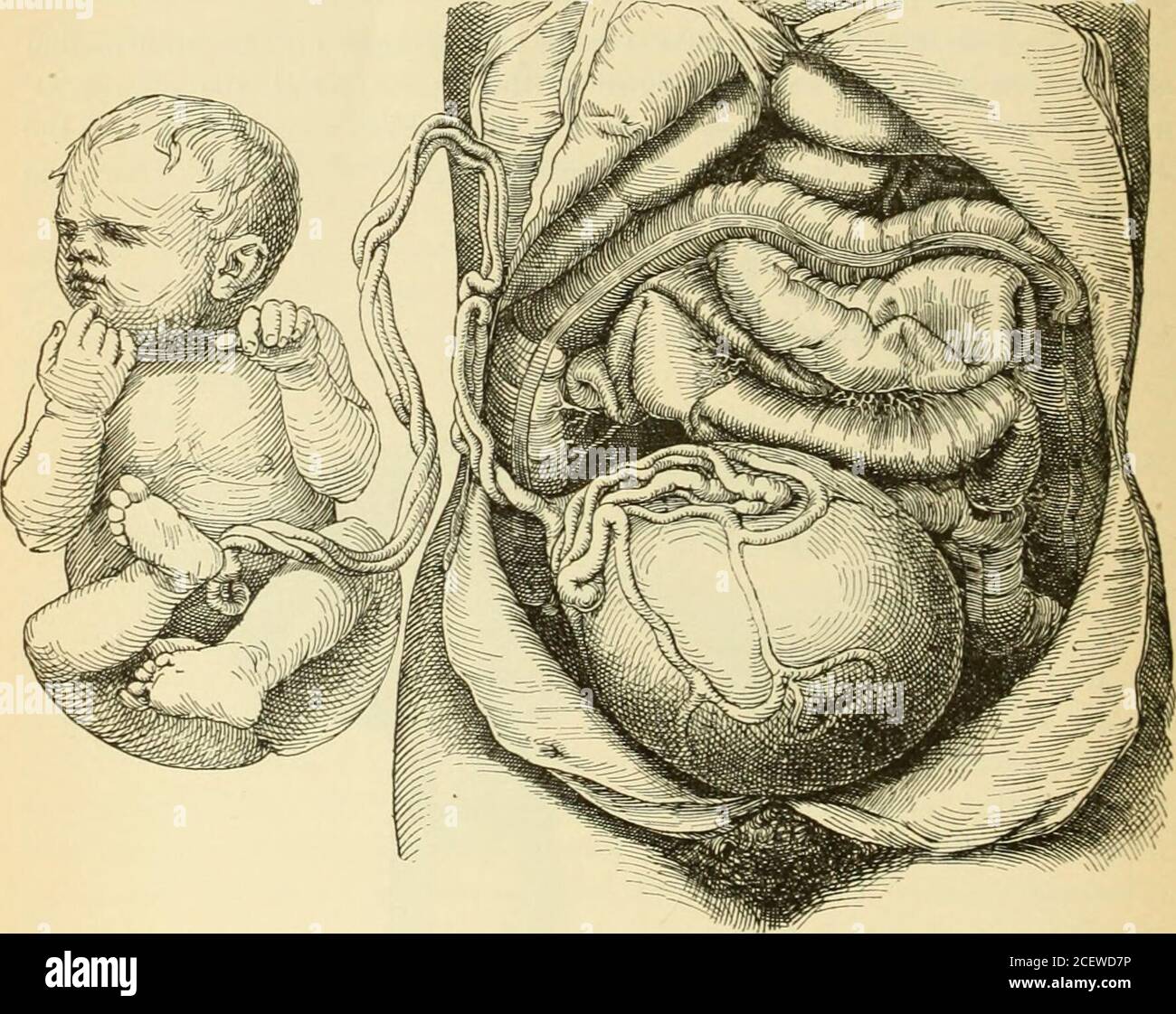 Round ligament of uterus hi-res stock photography and images - Alamy