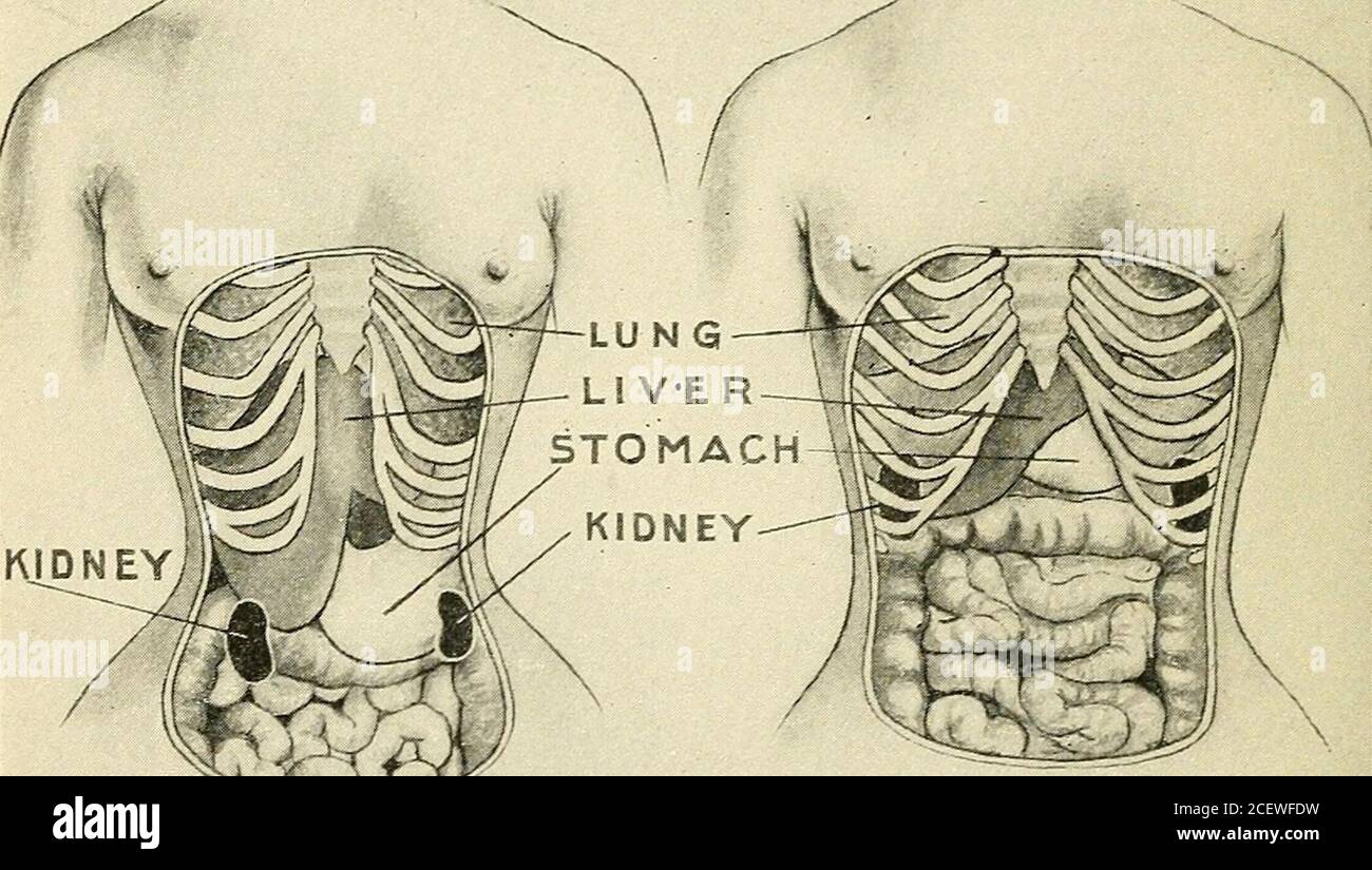 Whalebone corset hi-res stock photography and images - Alamy