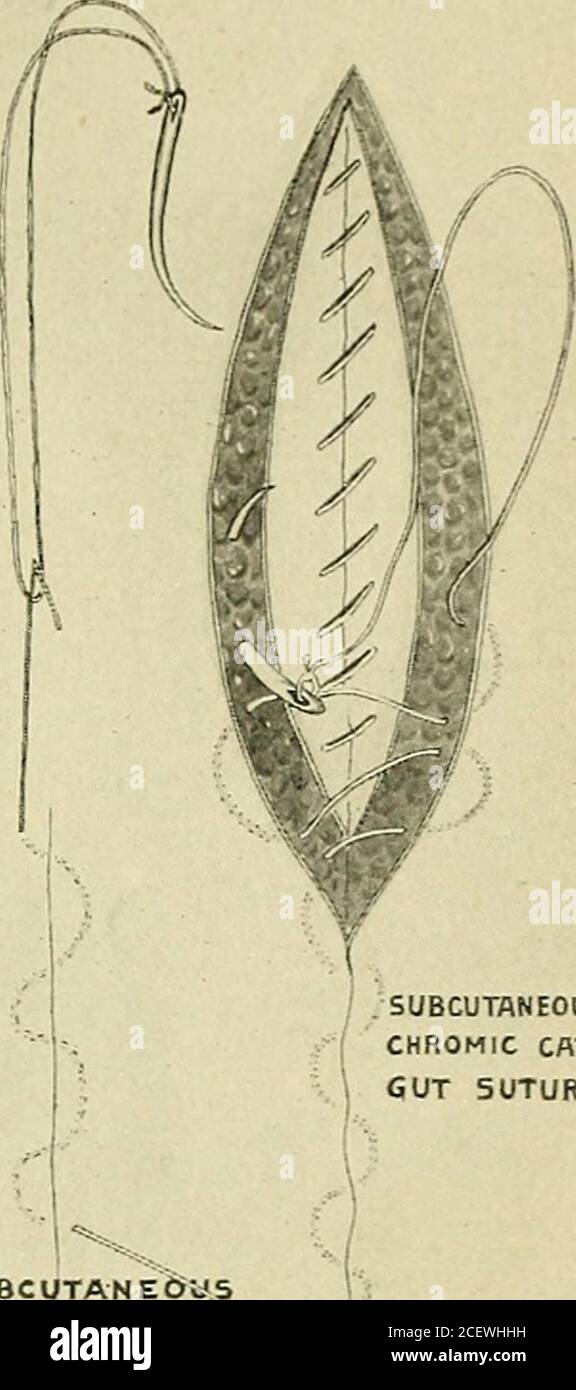 . The Principles and practice of gynecology : for students and ...