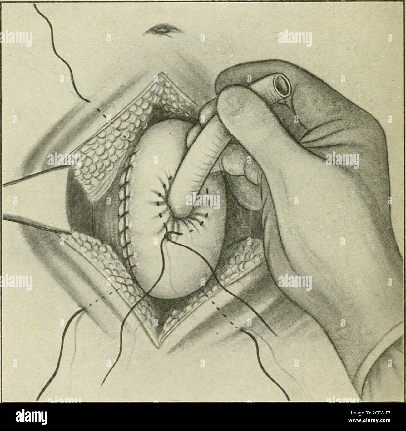 . A manual of gynæcology and pelvic surgery, for students and ...