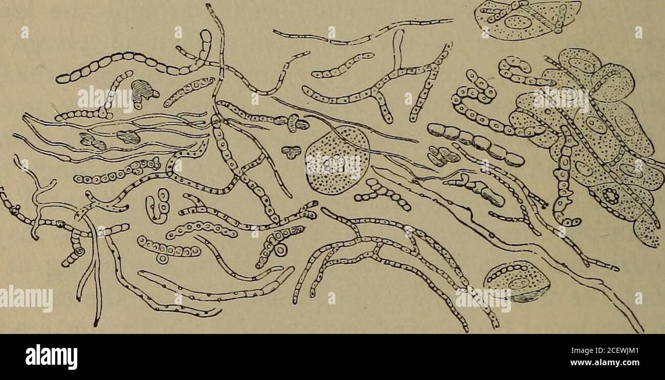 . The ready-reference handbook of diseases of the skin. ning tooccur in ...