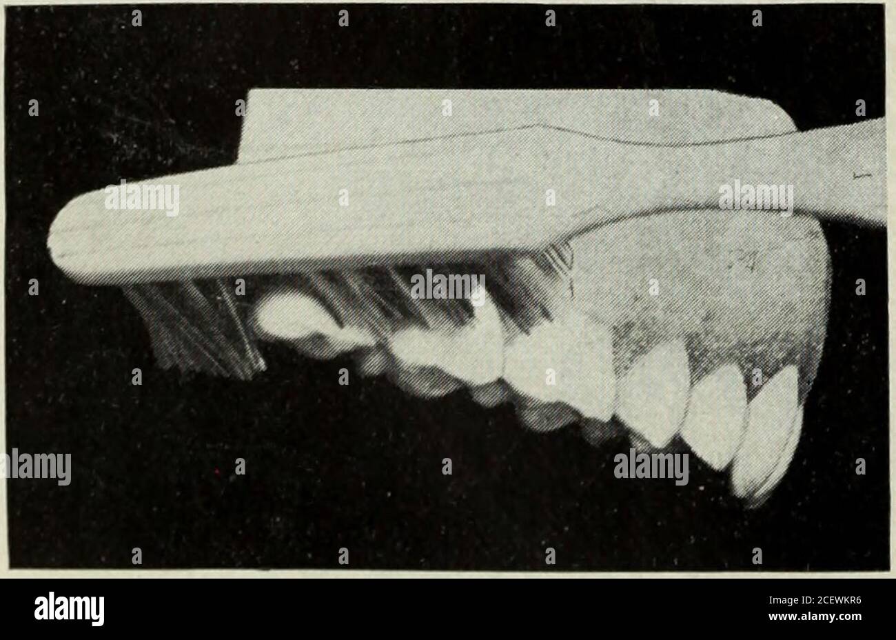Poste dental hi-res stock photography and images - Alamy