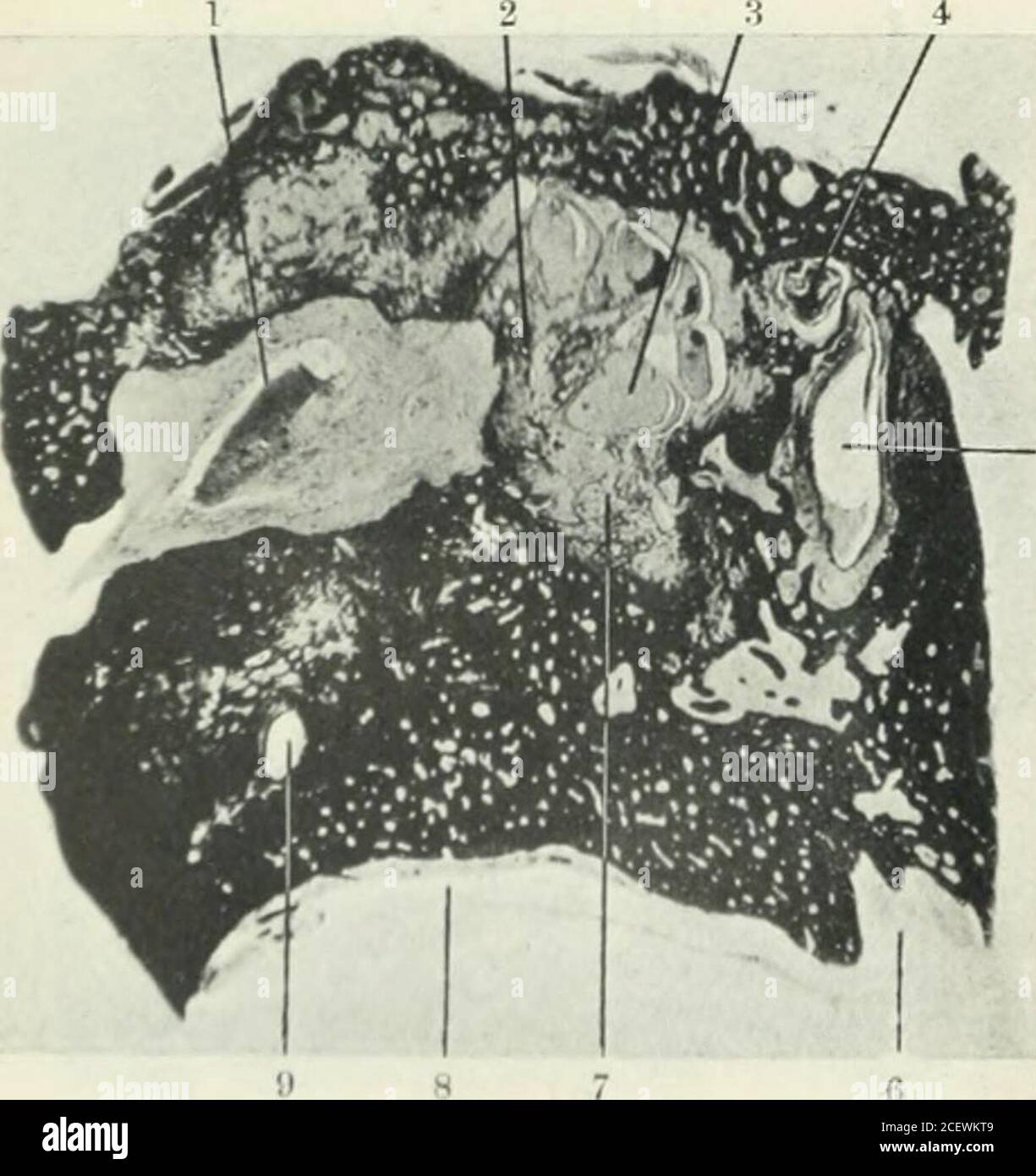 Jugular bulb hi-res stock photography and images - Alamy