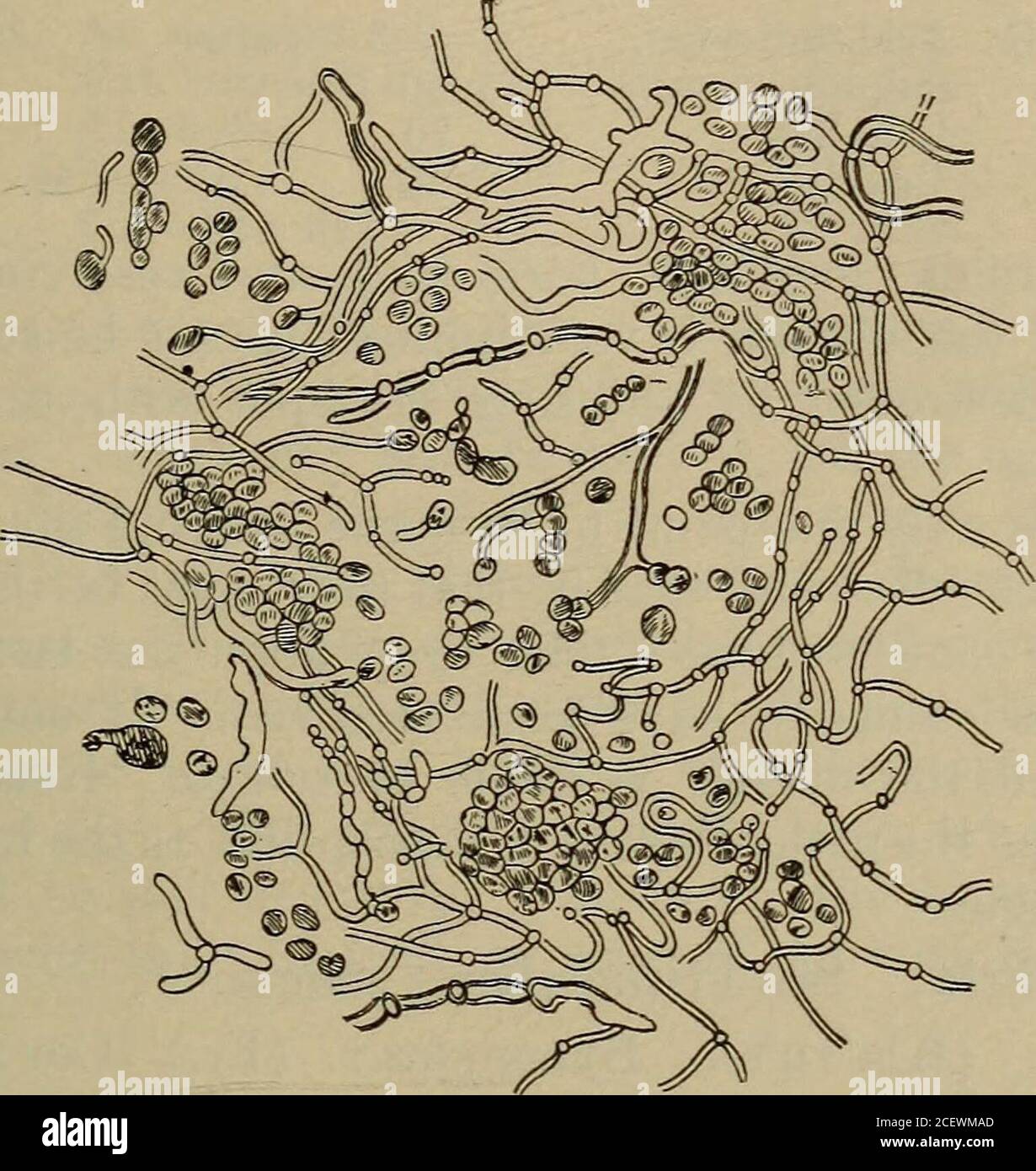 Cafe au lait skin pigmentation hi-res stock photography and images - Alamy