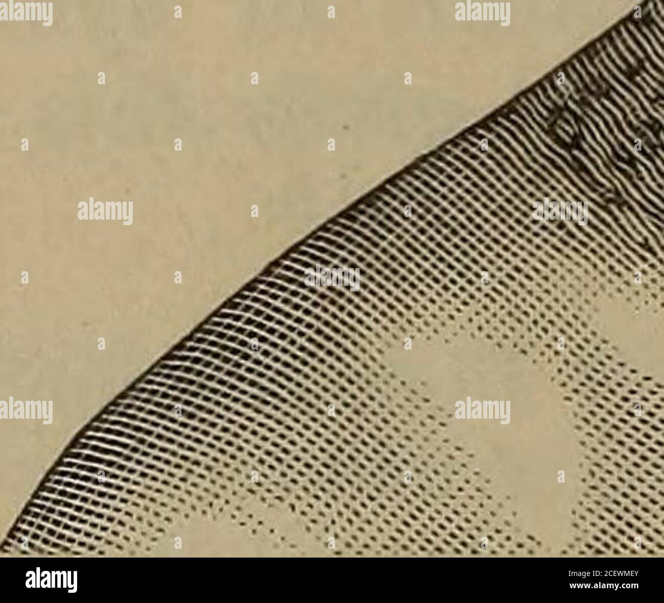 Atrophoderma hi-res stock photography and images - Alamy