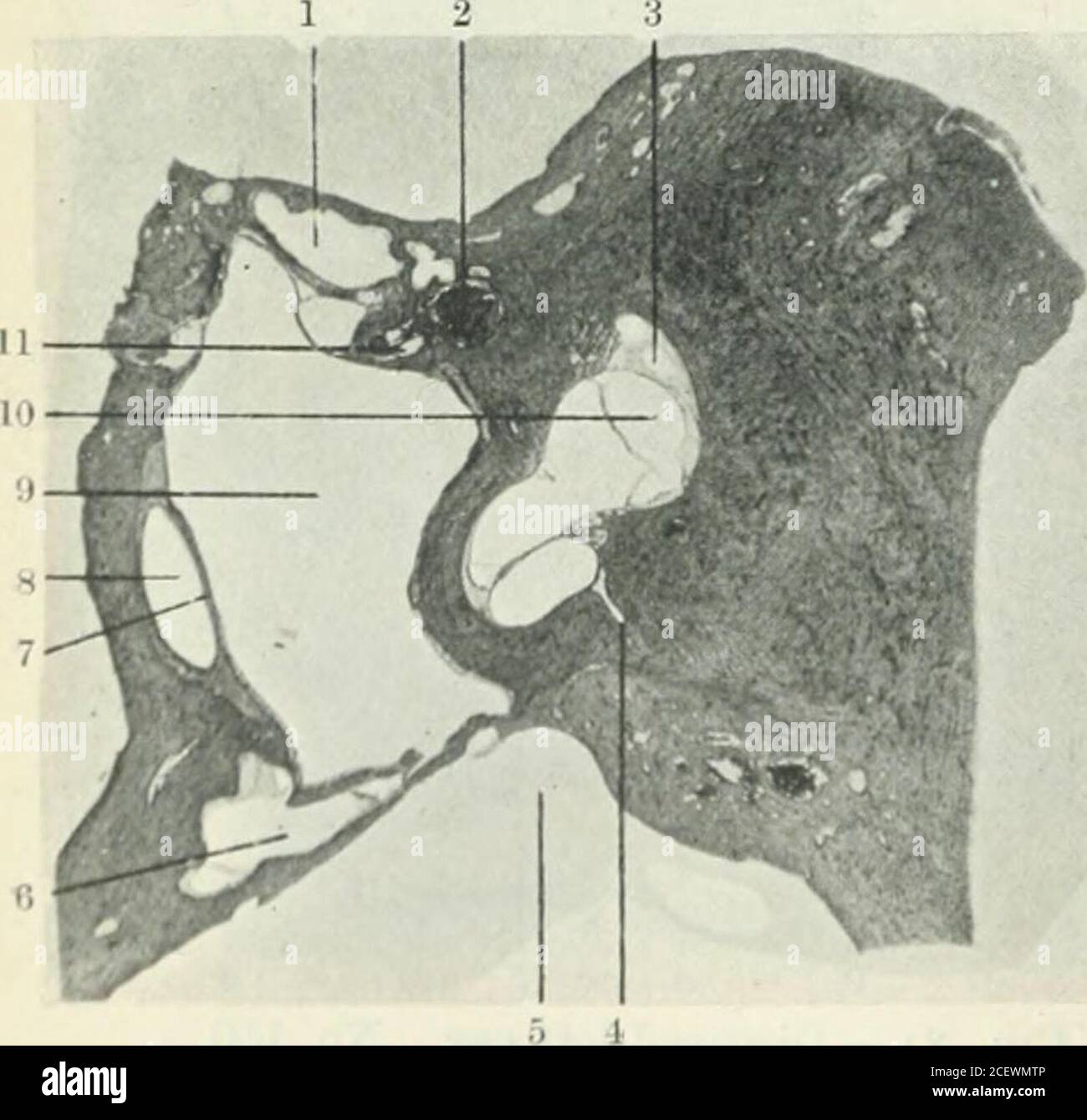 . The Journal of laryngology and otology. 9 a 7 0 Fig. 2a.—Diseased ...