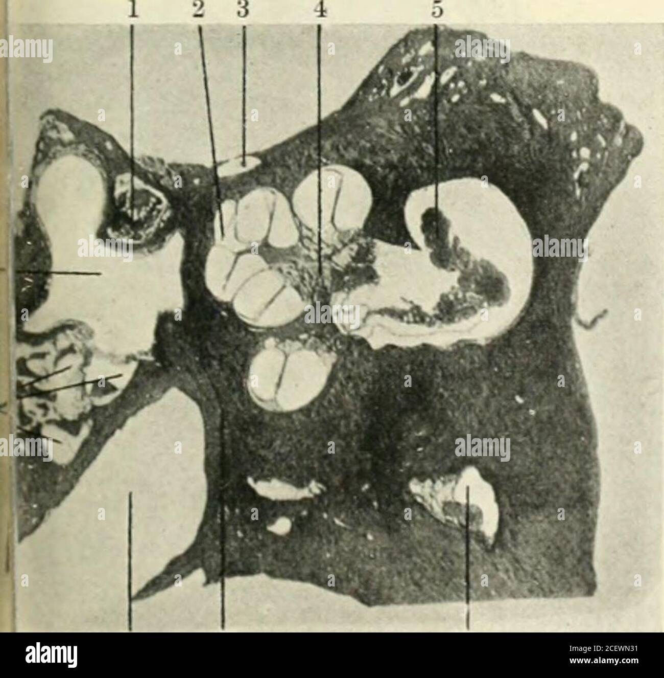 Lamellar bone hi-res stock photography and images - Alamy