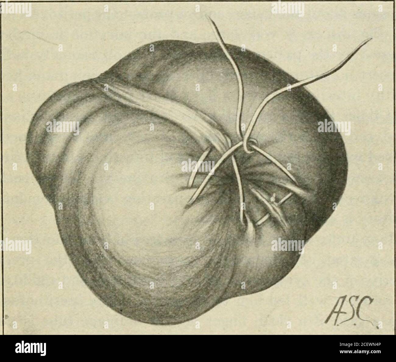 . A manual of gynæcology and pelvic surgery, for students and ...