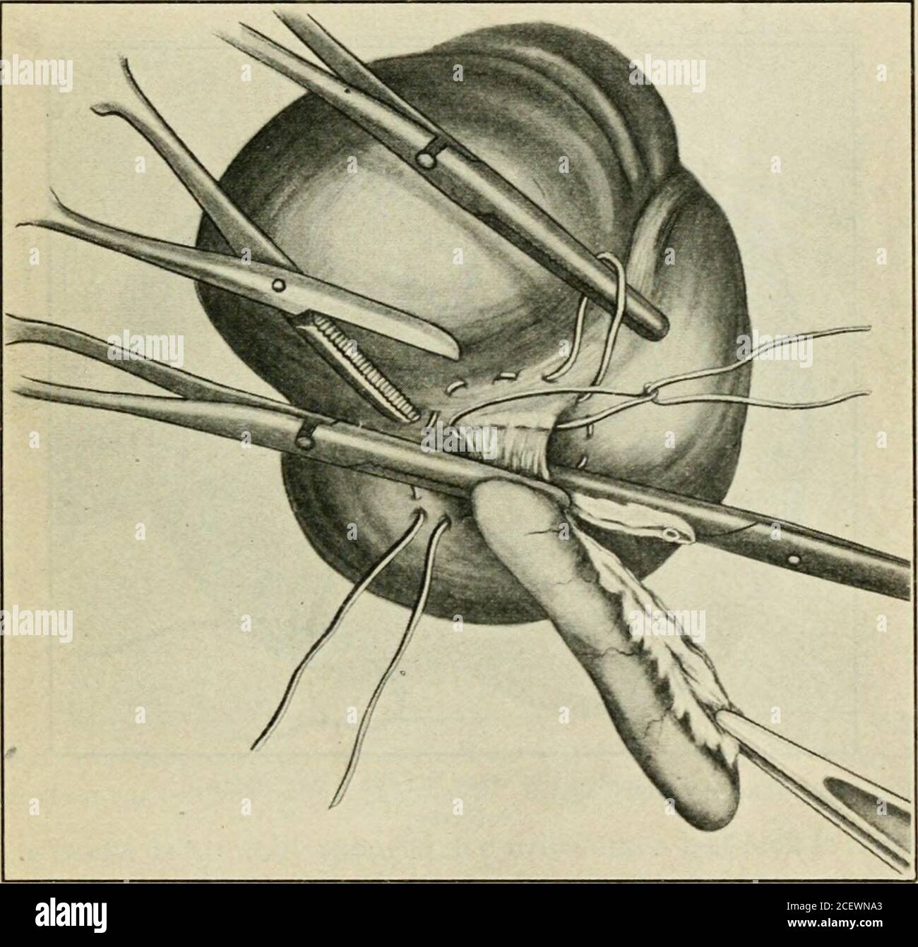 Drawn stumps hi-res stock photography and images - Alamy