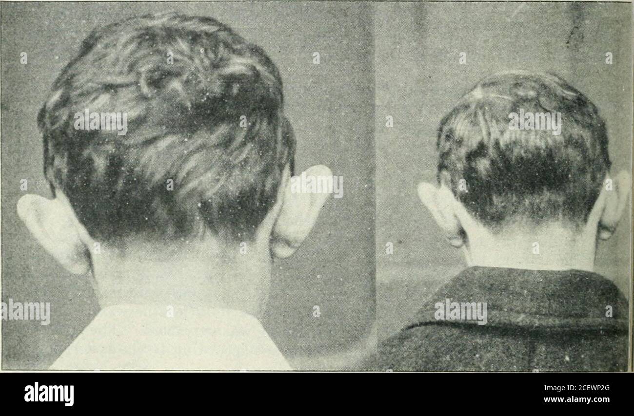 Suturing head wound hi-res stock photography and images - Alamy