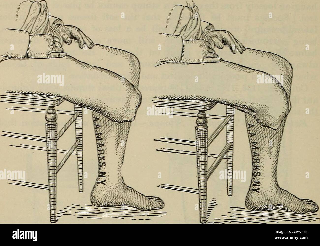 Well artificial limbs hi-res stock photography and images - Alamy