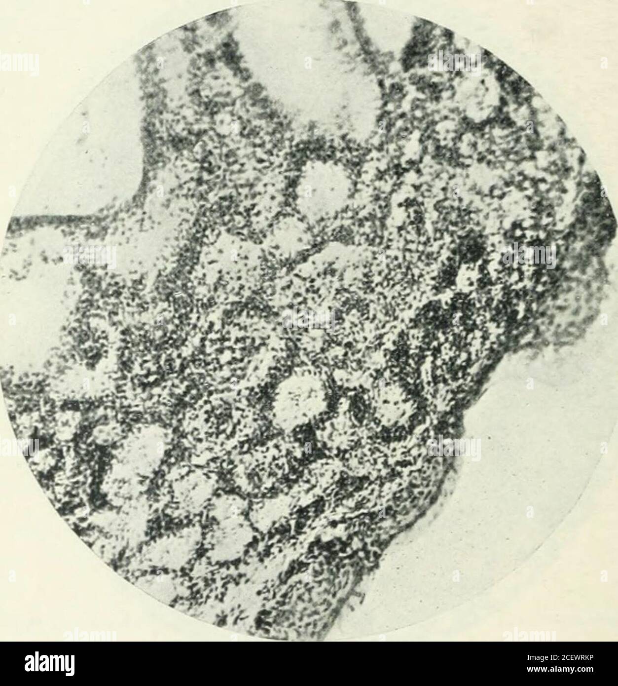 Laboured breathing hi-res stock photography and images - Alamy