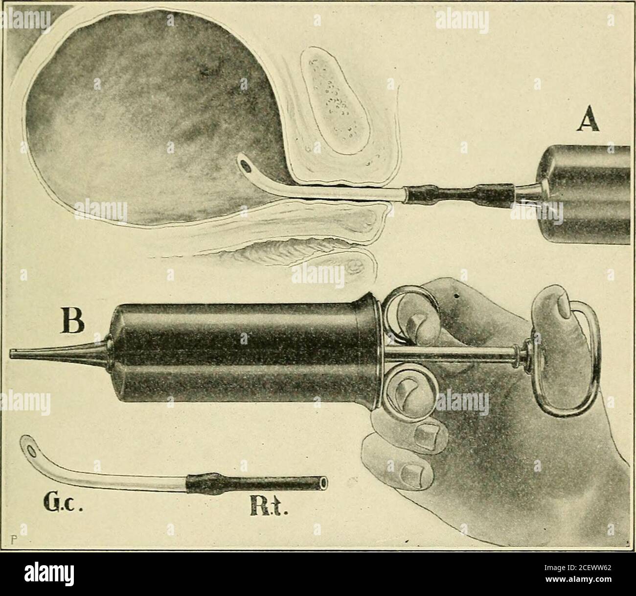 Cystoscope High Resolution Stock Photography and Images - Alamy