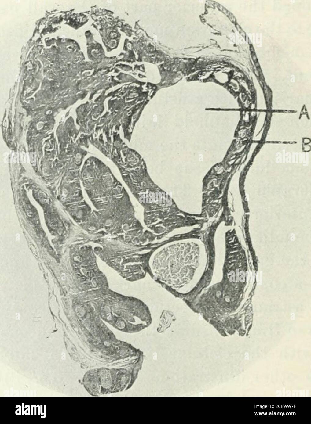 Retrogressing hi-res stock photography and images - Alamy