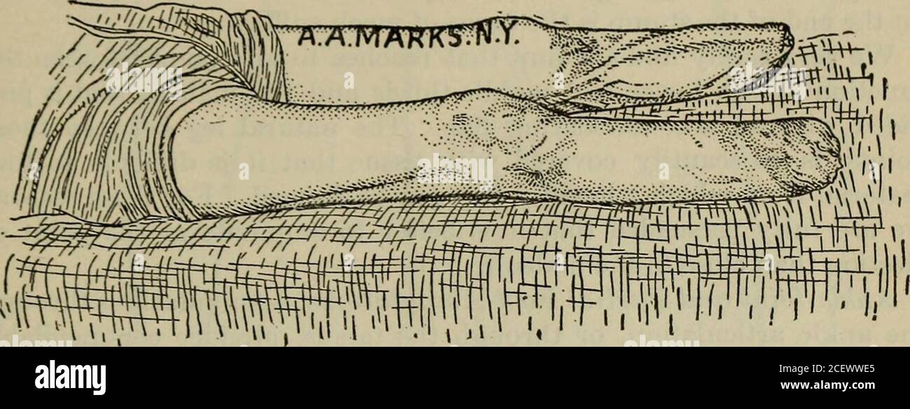 Retracted flaps hi-res stock photography and images - Alamy