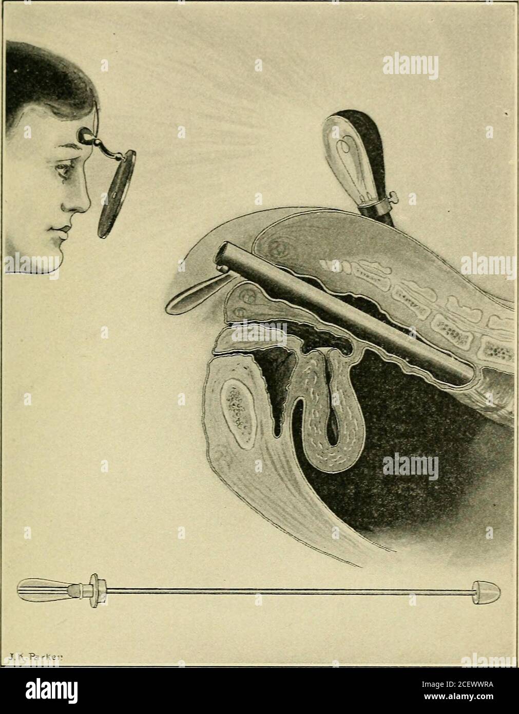 Frequent Urination High Resolution Stock Photography and Images - Alamy