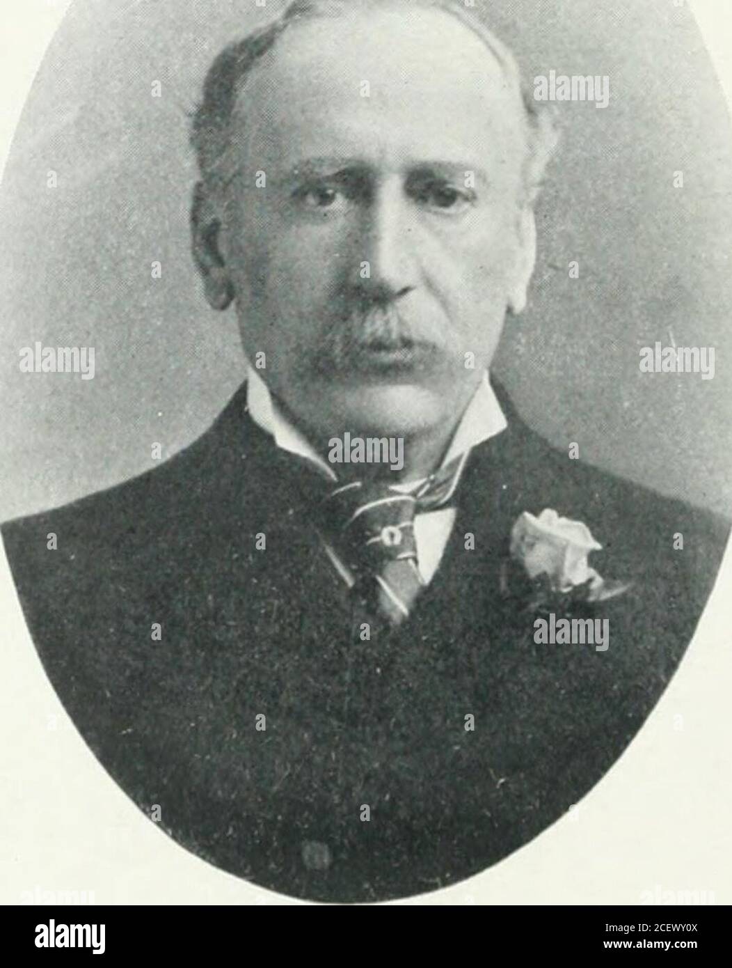 Glottiscope hi-res stock photography and images - Alamy