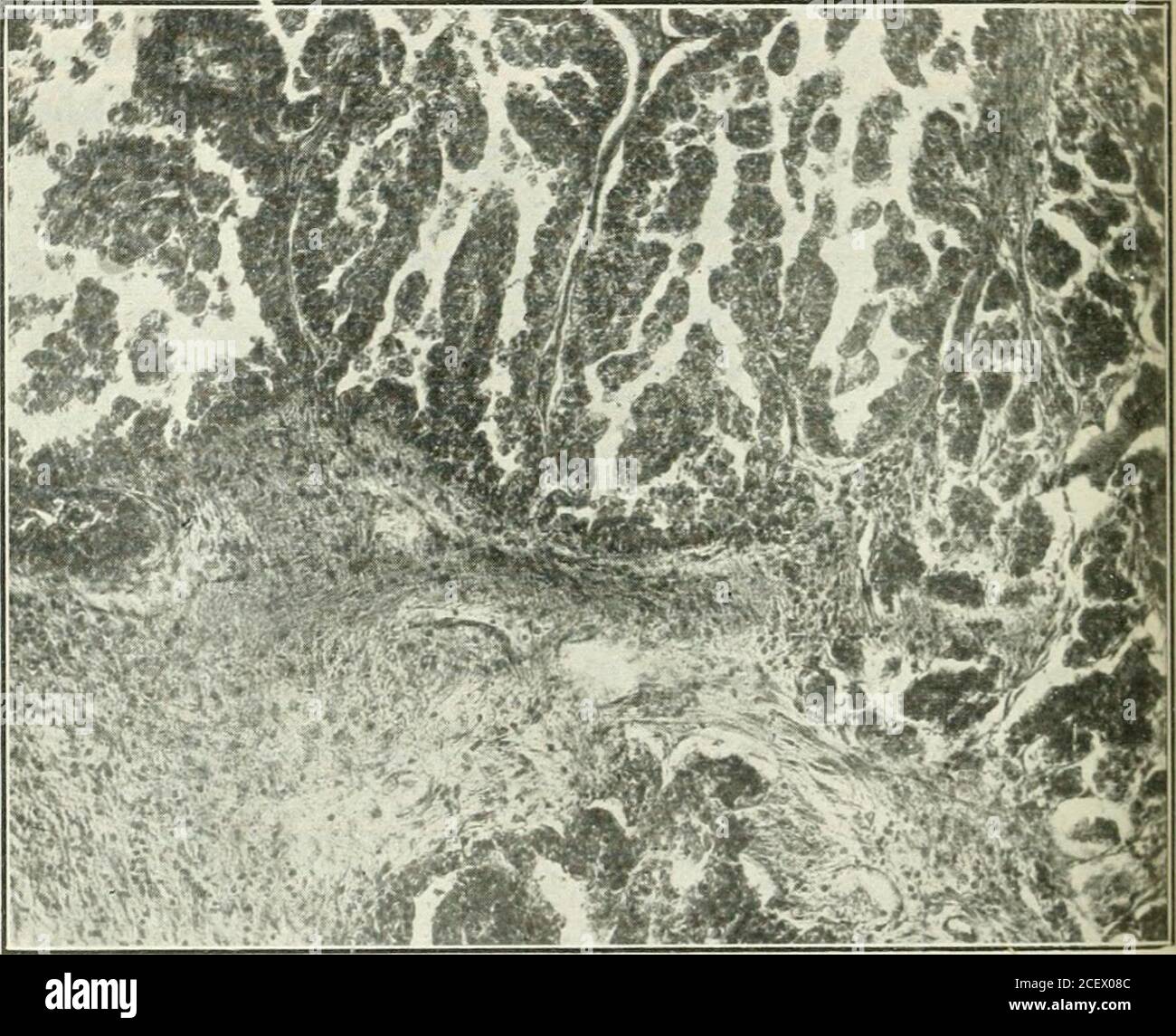 . A manual of gynæcology and pelvic surgery, for students and ...