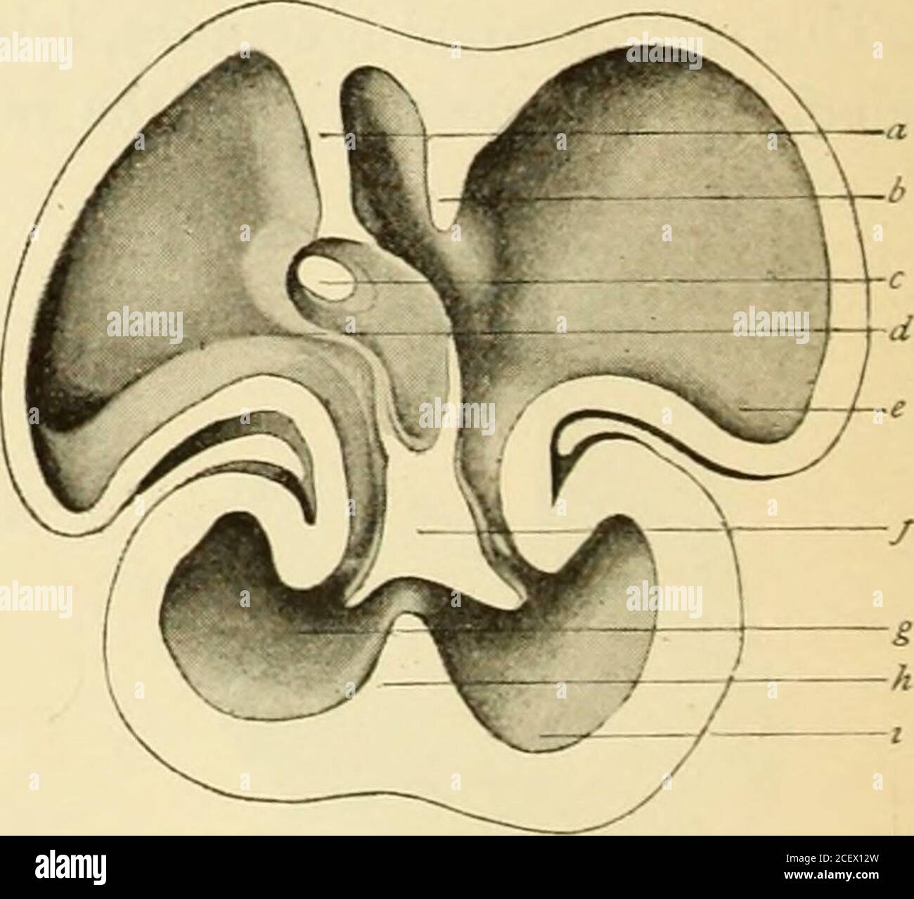 Interventricular Foramen Heart