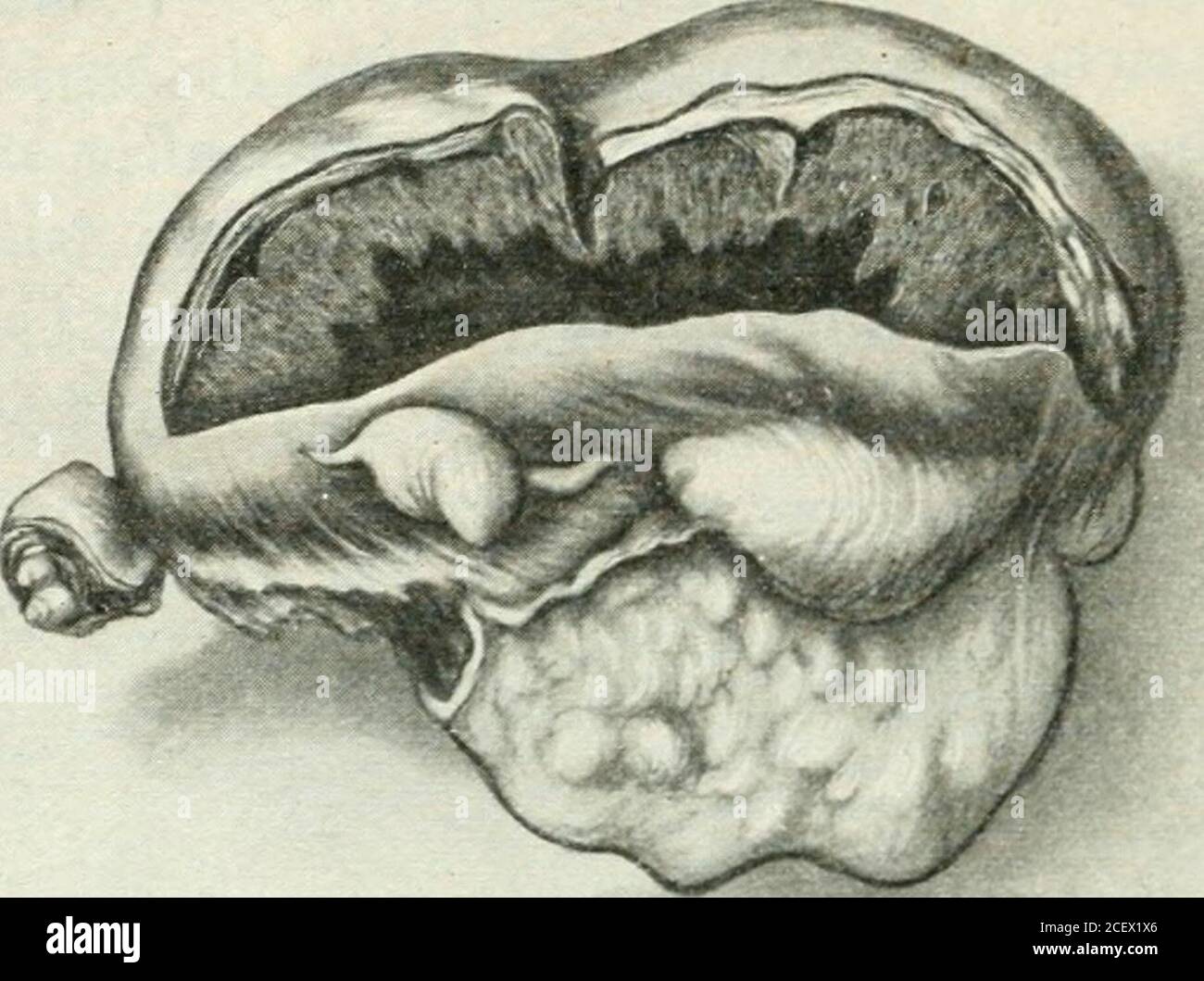 . A manual of gynæcology and pelvic surgery, for students and ...